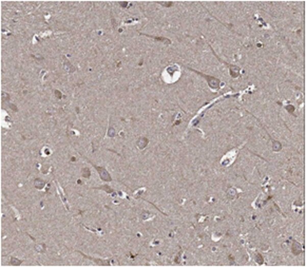 Anti-Amyloid Beta (ABeta) x-42 Antibody, clone 12F4 | 05-831-I